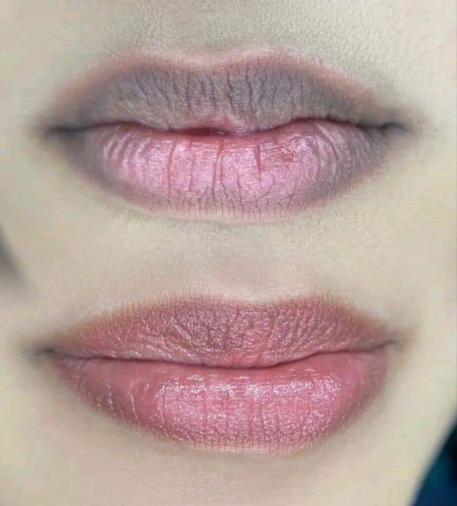 Ana Román Micropigmentación Micropigmentación de labios antes y después ...